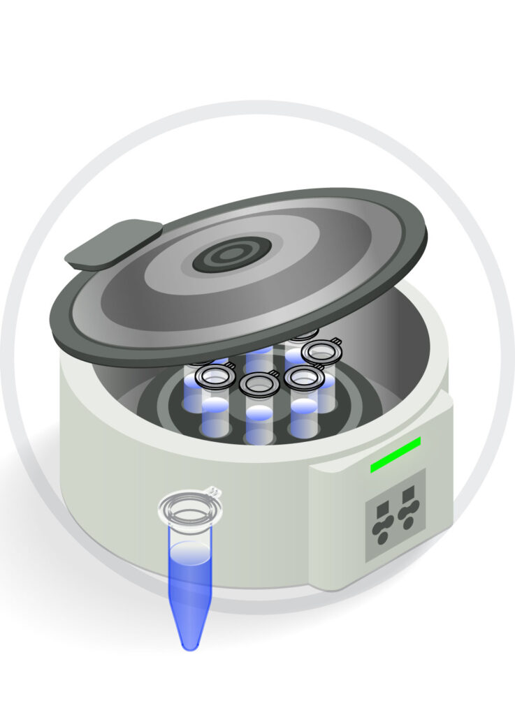 In Vitro Diagnostics - Key Tech